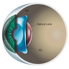 Drishti – Eye Centre & best in Faridabad