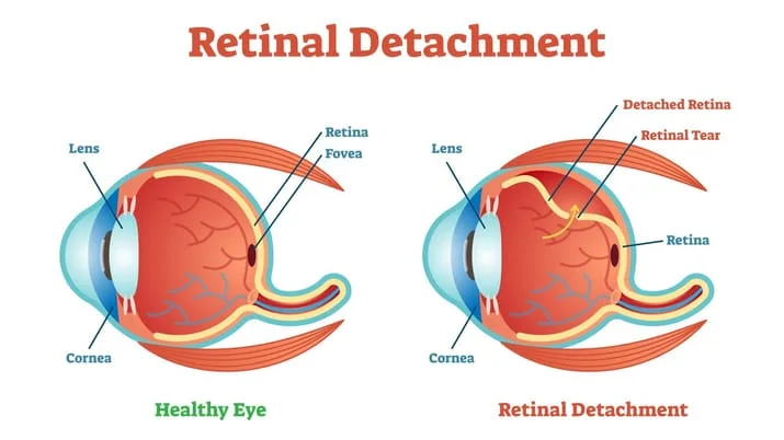 Drishti – Eye Centre & best in Faridabad