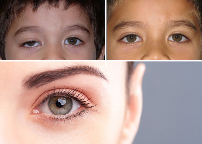 Drishti – Eye Centre & best in Faridabad